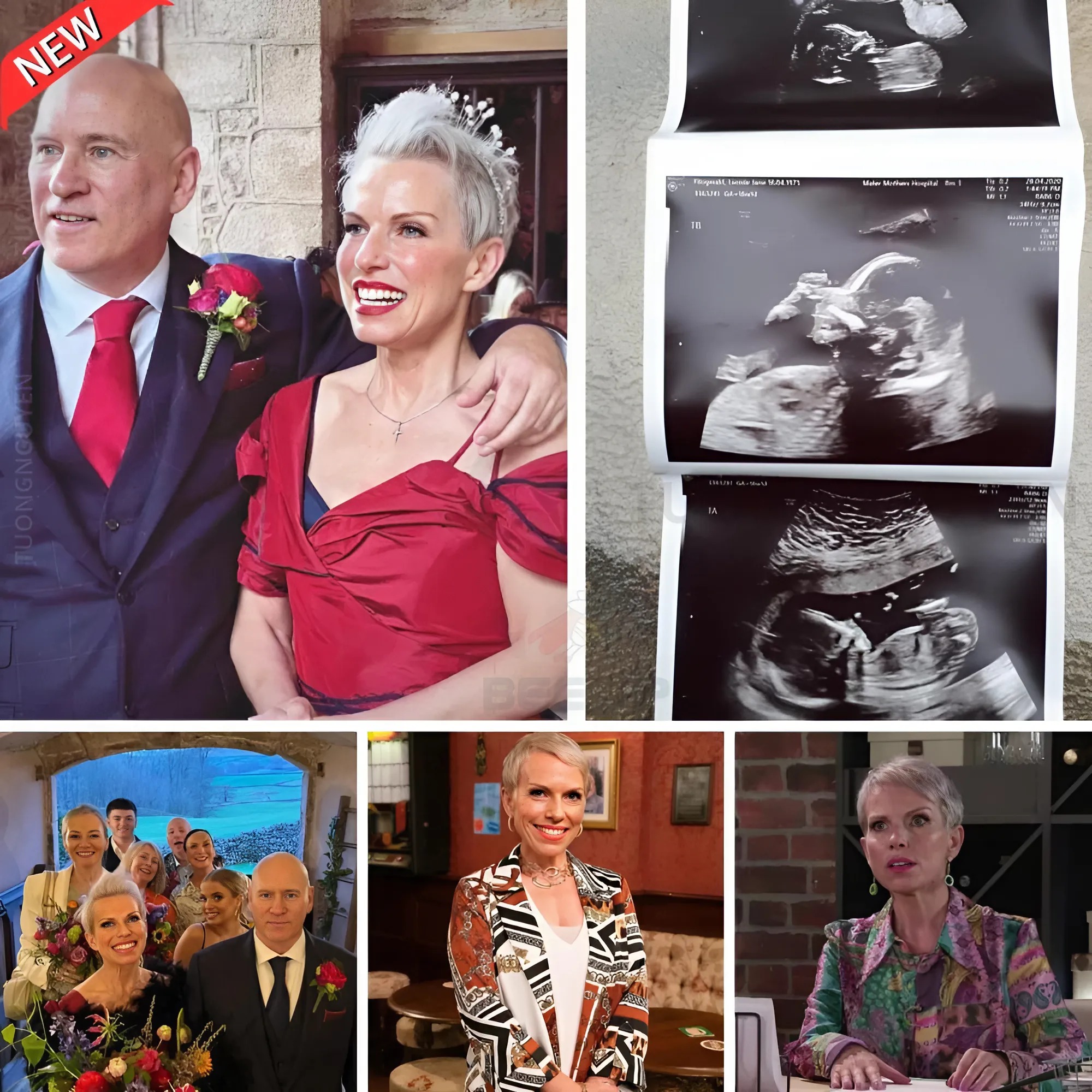 BREAKING !!! Coronation Street icon Sue Devaney Stuns Fans with Family ...